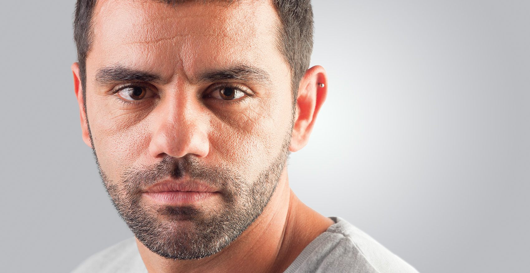 Nose correction for a wide nose / boxer nose – Rhinoplasty at the Rhino ...